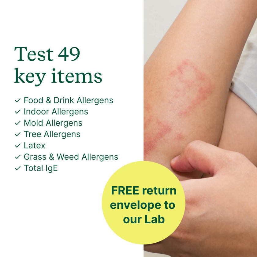 Skin Allergy Test Kit – Check My Body Health UK