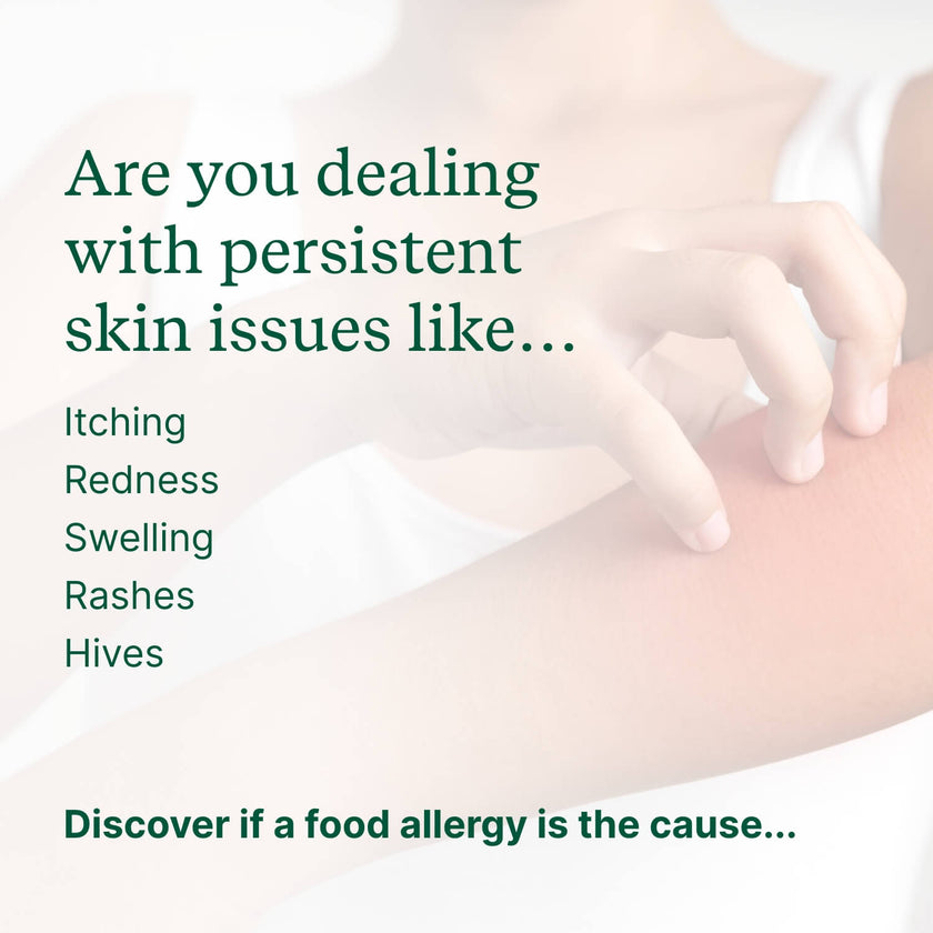 Skin Allergy Test Kit – Check My Body Health UK